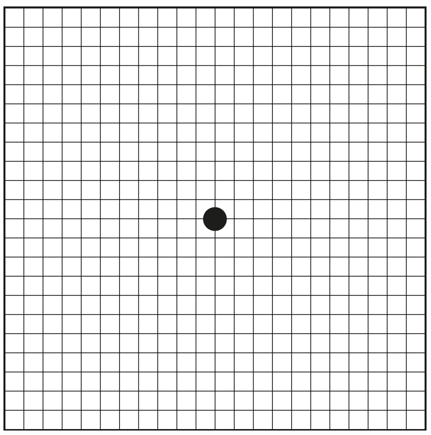 Testing Macula Function With The Amsler Vision Test Know The Eye Testing Macula Function With The Amsler Vision Test Know The Eye