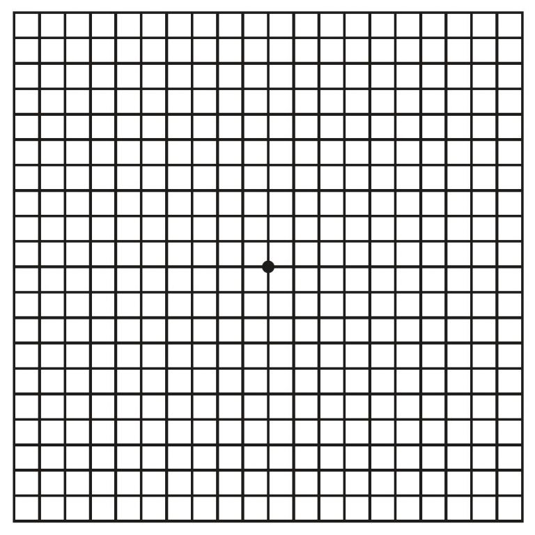 Sehtest mit dem Amsler-Test